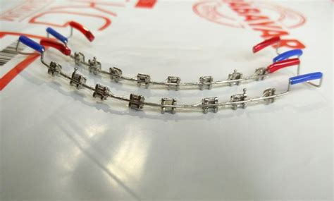 Pin By Click Braces On Trending Fake Braces How To Apply Fake