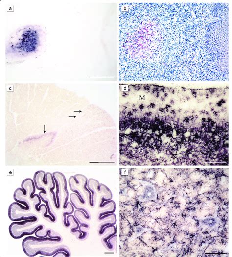Characteristic Prp Sc Deposition Patterns In Classical And Download Scientific Diagram