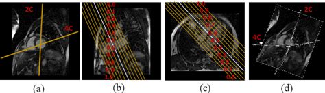 Self Supervised Learning For Medical Image Data With Anatomy Oriented Imaging Planes Paper And Code