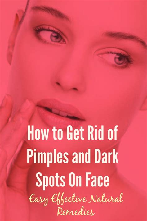 How To Reduce Pimple Marks Naturally At Home