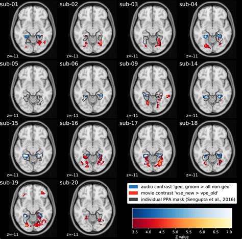 Fixed Effects Individual Level Glm Results Z 34 P