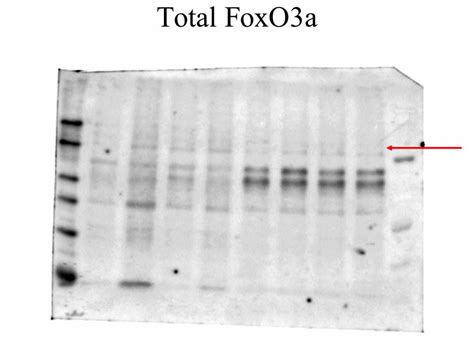 On The Biochemical Associations Of FoxO A And SirT With The Stress Resistance Of Cells From The