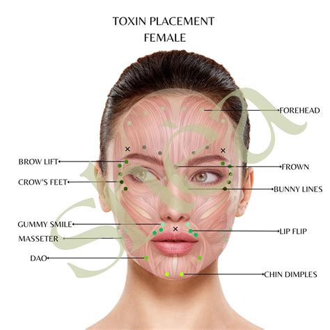 Toxin Injection Placement Chart Female Aesthetic Injector Guide