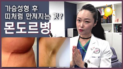 가슴성형 후 발생 가능 한 몬도르병 Mondor s disease YouTube