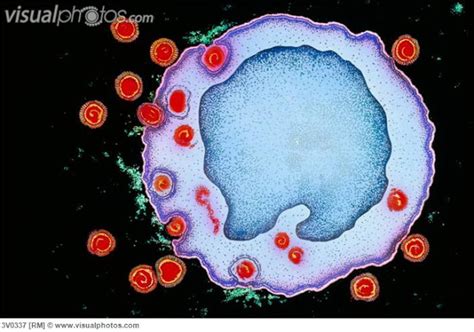 Im Paciente Blog Cura Para O Hiv