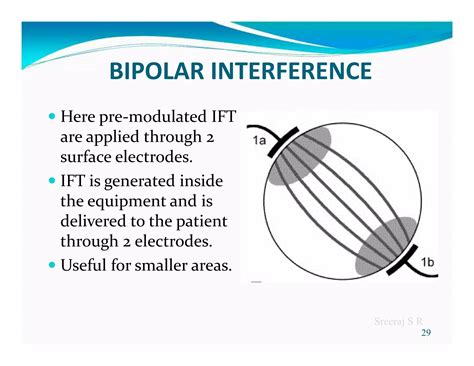 Interferential Therapy Pdf