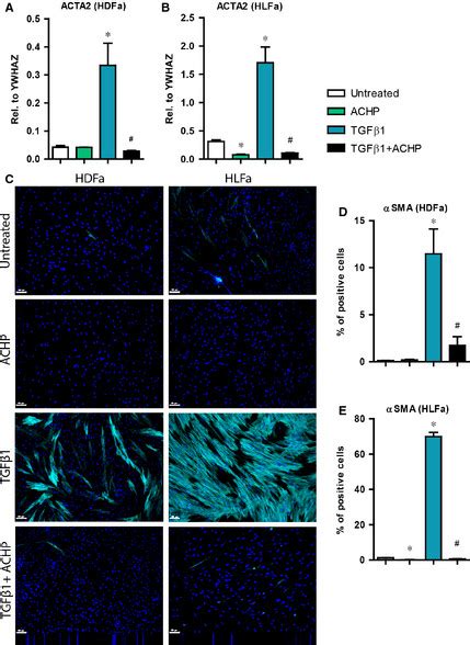 Effects Of Achp On Transforming Growth Factor Beta1 Tgfβ1 Induced Download Scientific Diagram