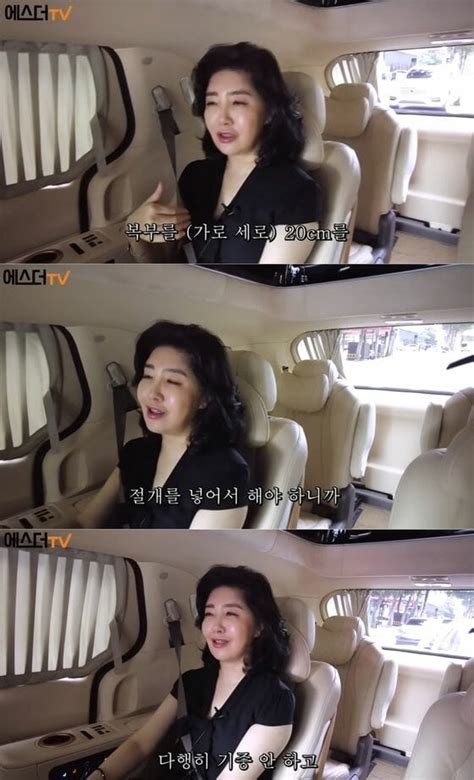 여에스더 동생 간염으로 사망 위기 내 간 떼주려 했었다” Zdnet Korea