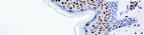 Leveraging Clinical Trial Ready Ihc Assays From Target Validation To