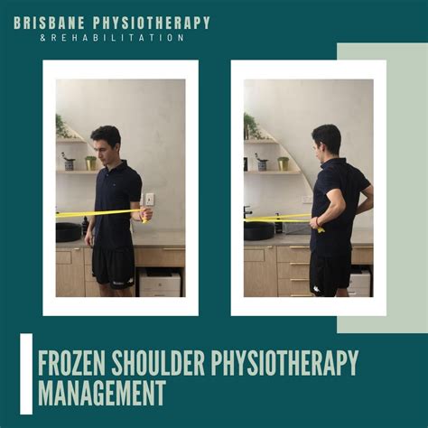 Frozen Shoulder Physiotherapy Management Brisbane Physiotherapy