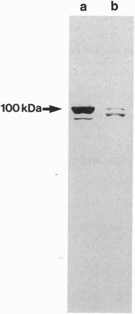 Immunoblot Analysis Of Partially Purified Dynamin From Rat Brain And Download Scientific