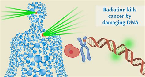 Radiation Sickness Treatment Herbal Remedies