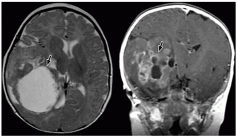 Brain Radiology Key
