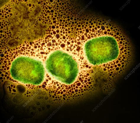 Mpox Virus Particles Tem Stock Image C0577419 Science Photo Library