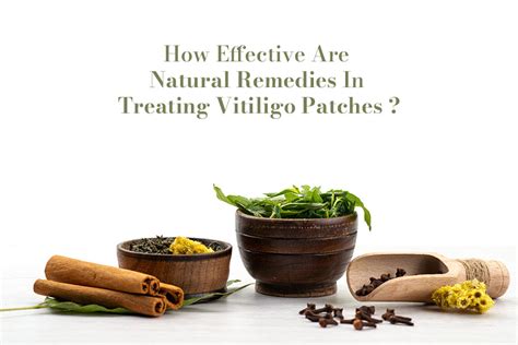 How Effective Are Natural Remedies In Treating Vitiligo Patches