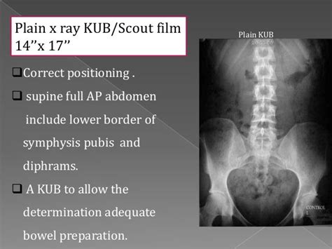 Intravenous Urogram