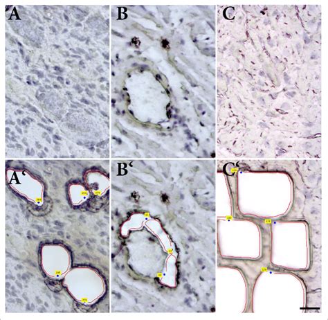Laser Assisted Microdissection Tissue Sections Before And After The