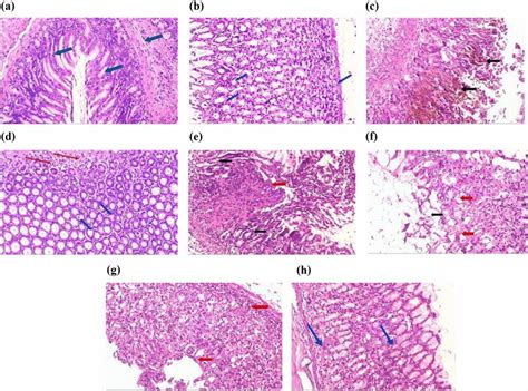 A Normal Control Group Showing Normal Gastric Mucosal Glands Consisting