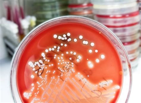 Isolation And Identification Of Staphylococcus Aureus Microbial Notes