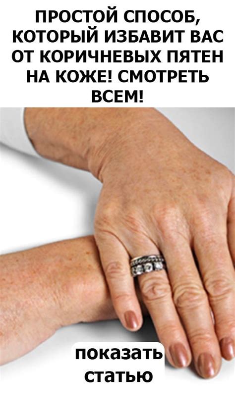 Простой способ который избавит Вас от коричневых пятен на коже Смотреть всем Кожа Полезные