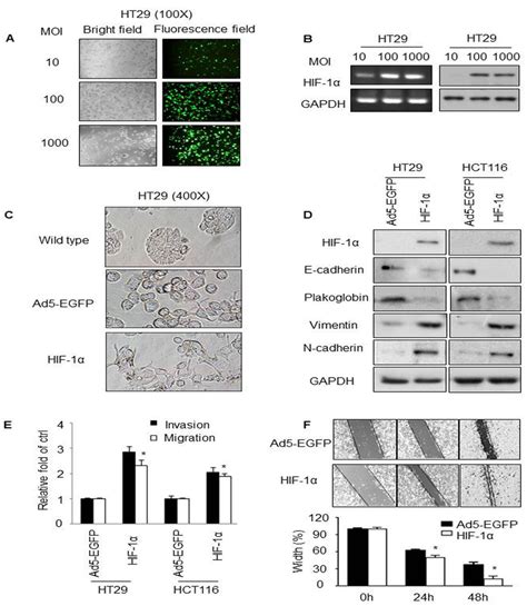 Overexpression Of Hif 1α Induced Emt And Metastasis In Crc Cell Download Scientific Diagram