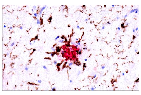 Signalstain® Ihc Dual Staining Kit Hrp Rabbit Brown Ap Mouse Red