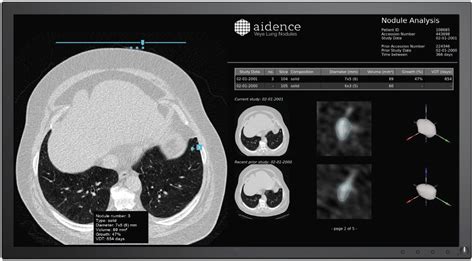 Ai And Medical Diagnosis A Compact Guide