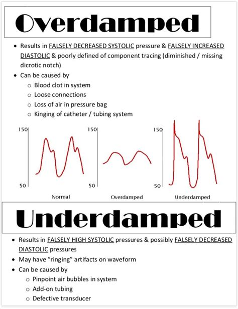 Understanding Sound Waves Diagram