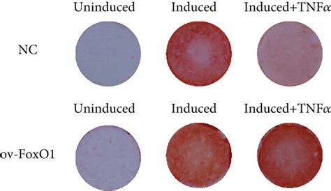 foxo1 overexpression enhanced osteogenic differentiation in hpdlscs