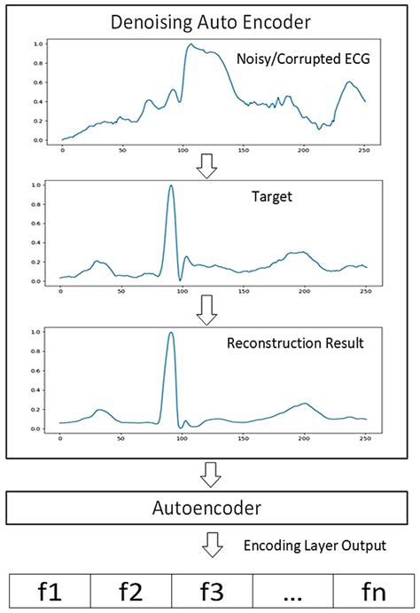 deep learning based stacked denoising and autoencoder for ecg heartbeat classification