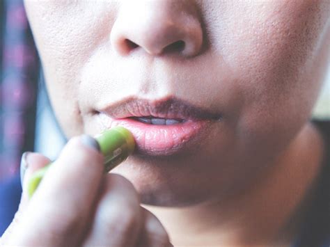 Sunburned Lips Swelling Healing Time And More