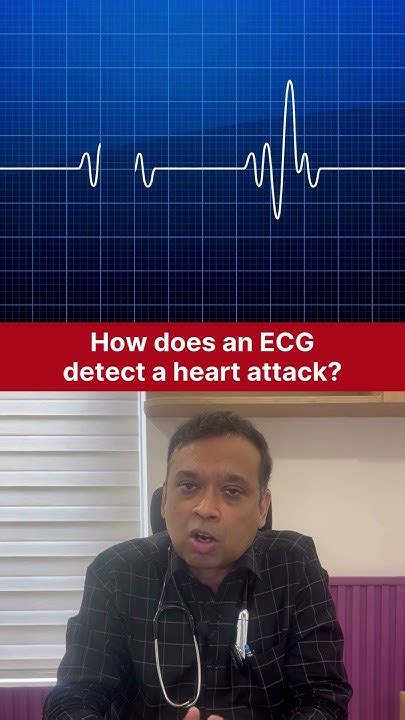 Understanding Ecg How A Simple Test Can Save Lives Doctor