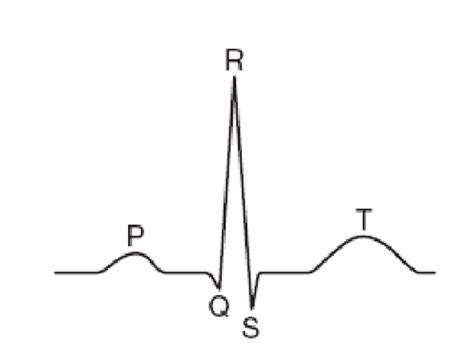 Ecg Ekg Flashcards Quizlet