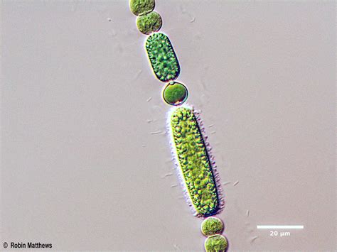 Cyanobacteria Nostocales Nostocaceae Anabaena Echinospora Anabaena