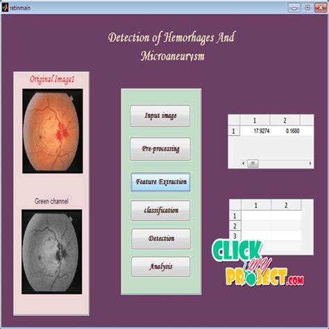 Automated Feature Extraction For Early Detection Of Diabetic Retinopathy In Fundus Images