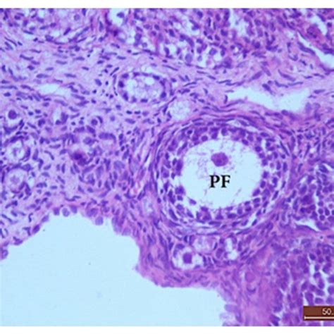 Hande ×400 Photomicrograph From G I Ovary Ovarian Section From G I Rat Download Scientific