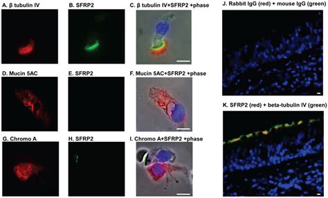 Co Localization Of Sfrp2 And Ciliated Cell Specific Marker β Tubulin Download Scientific