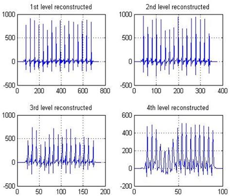 Figure 4 From Ecg Classification Using Learning Vector Quantization Semantic Scholar