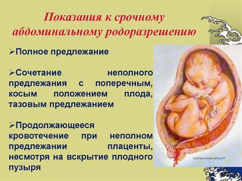 Акушерские кровотечения во время беременности Оказание неотложной