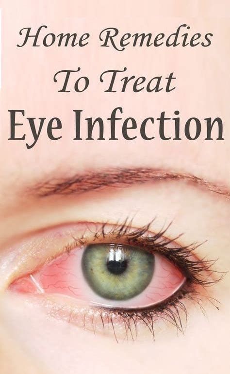 How To Cure An Eye Infections In 24 Hours Naturally Healthy Lifestyle