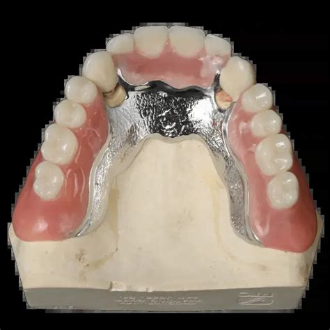Precision Attachment Repair Gdl