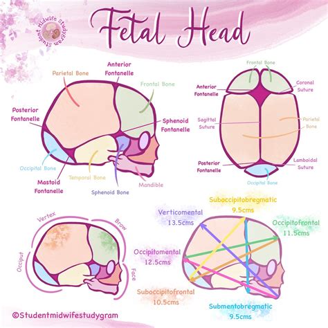 Student Midwife Studygram 💞 Polyhydramnios 💞 Polyhydramnios Pol E Hi