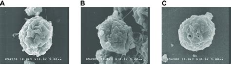 The Morphology Of Human Neutrophils Examined By Scanning Electron Download Scientific Diagram