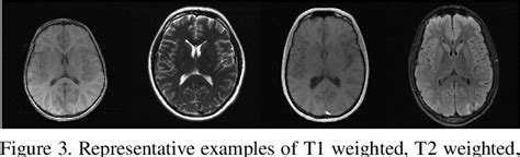 Figure 3 From Joint Deep Model Based Mr Image And Coil Sensitivity Reconstruction Network Joint