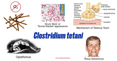 Clostridium Tetani Properties Pathogenesis Lab Diagnosis • Microbe Online