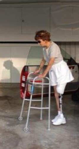 Prosthetics Flashcards Quizlet