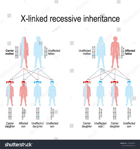 X Linked Recessive Inheritance Means That Gene Causing Trait Disorder