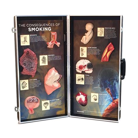 The Consequences Of Smoking 3d Display 78881 Health Edco Anatomystuff