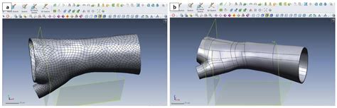 Upper Limb Orthoses Integrating Topology Optimization And 3d Printing