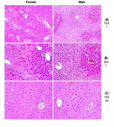 sex differences in inflammatory cytokine production in hepatic ischemia